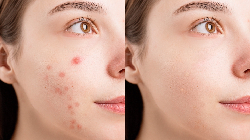 Edit foto hapus object, permak foto, ubah warna, edit 1 hari jadi