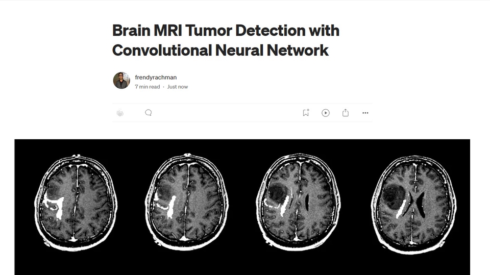 Pembuatan Model AI Pendeteksi Object atau Klasifikasi Gambar | Computer ...